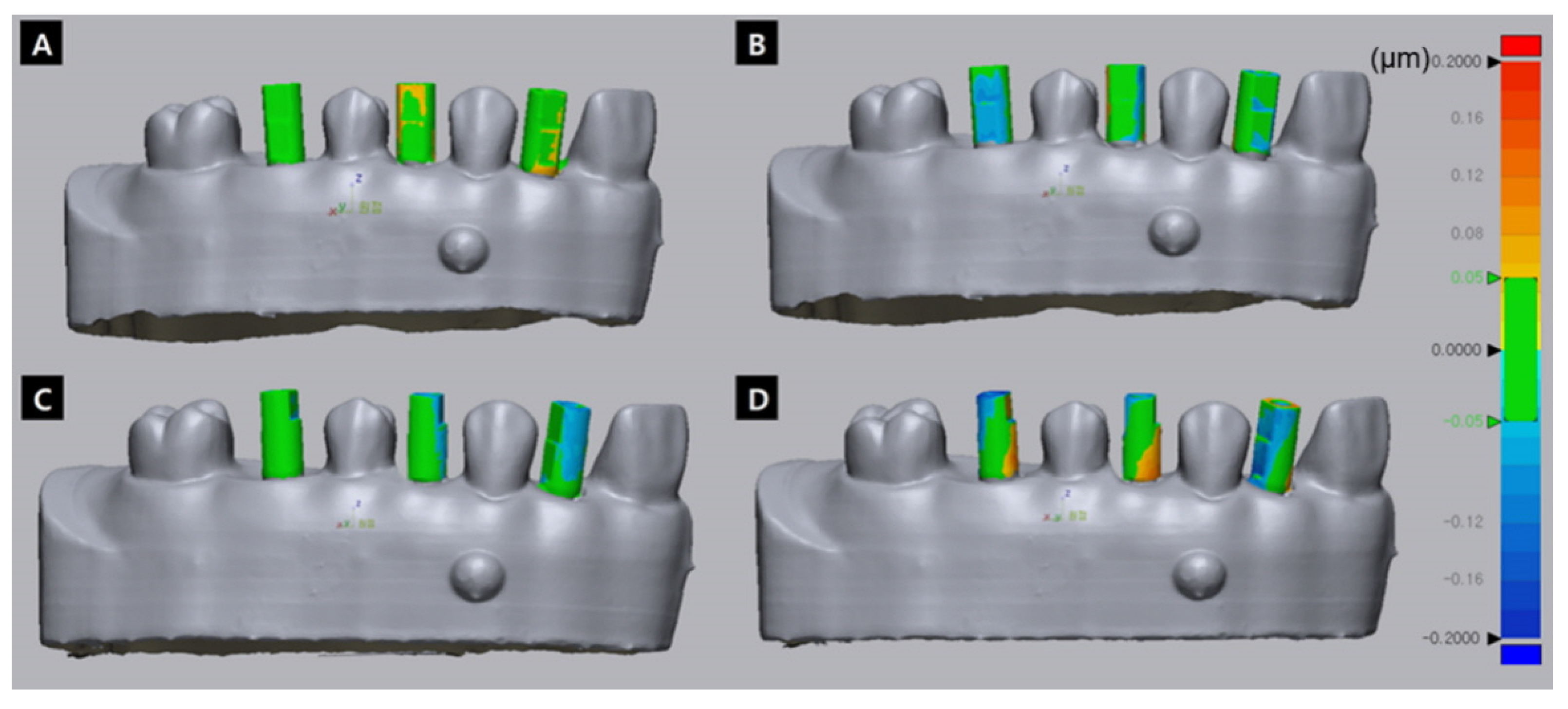 Evaluation of the Trueness of Digital Implant Impressions According to ...