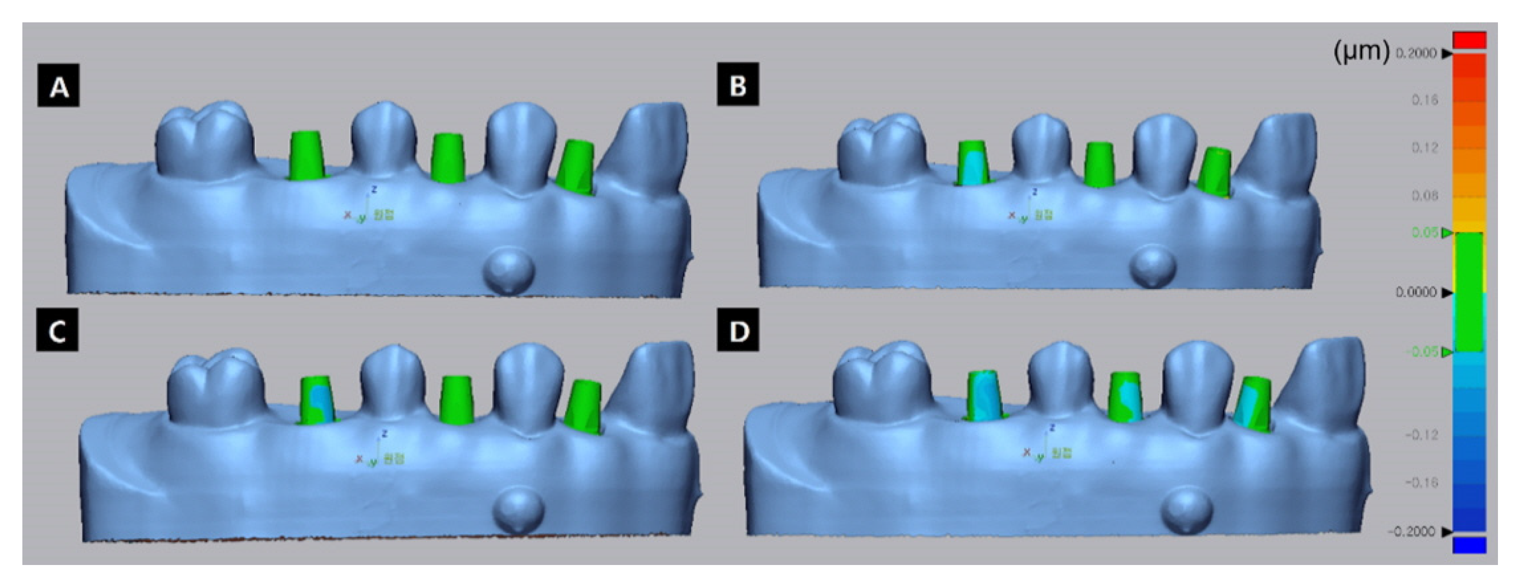 Evaluation of the Trueness of Digital Implant Impressions According to ...