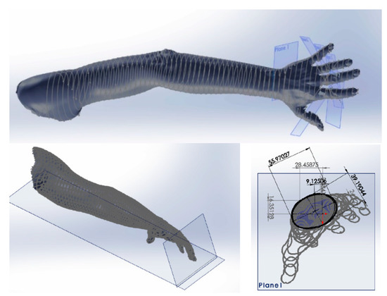 Concept, Design, Initial Tests and Prototype of Customized Upper Limb ...