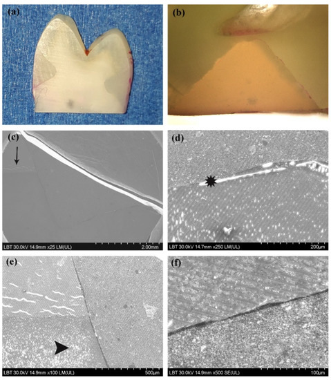 Adhesion of Flowable Resin Composites in Simulated Wedge-Shaped ...