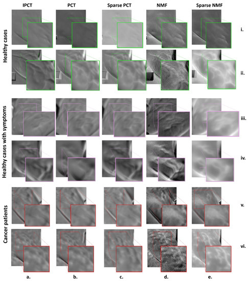 SPAER: Sparse Deep Convolutional Autoencoder Model to Extract Low ...
