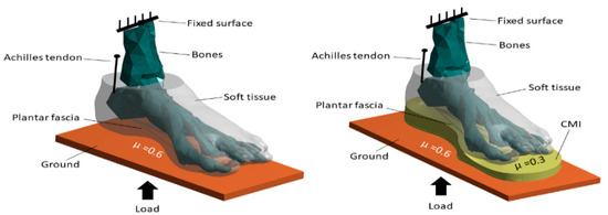 Effects of Custom-Made Insole Materials on Frictional Stress and ...