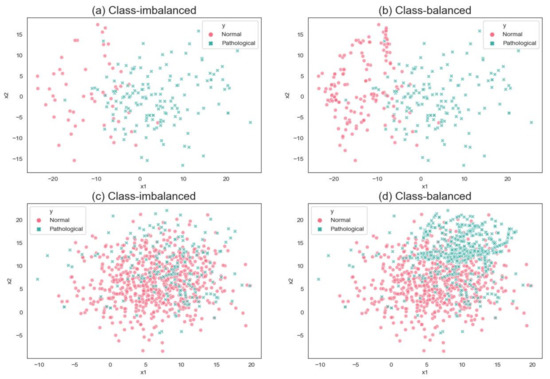 Class-Imbalanced Voice Pathology Detection and Classification Using Fuzzy Cluster Oversampling ...