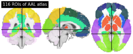 A Deep Learning Approach to Predict Autism Spectrum Disorder Using ...