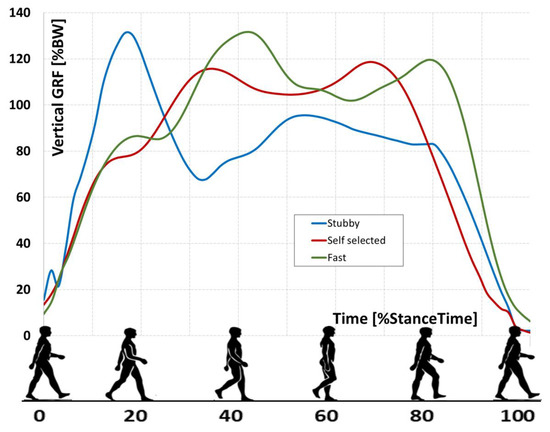 Applied Sciences | Free Full-Text | Using Stubby Prosthesis after ...