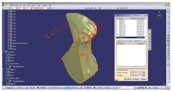 Finite Element Analysis of Mandibular Anterior Teeth with Healthy, but ...