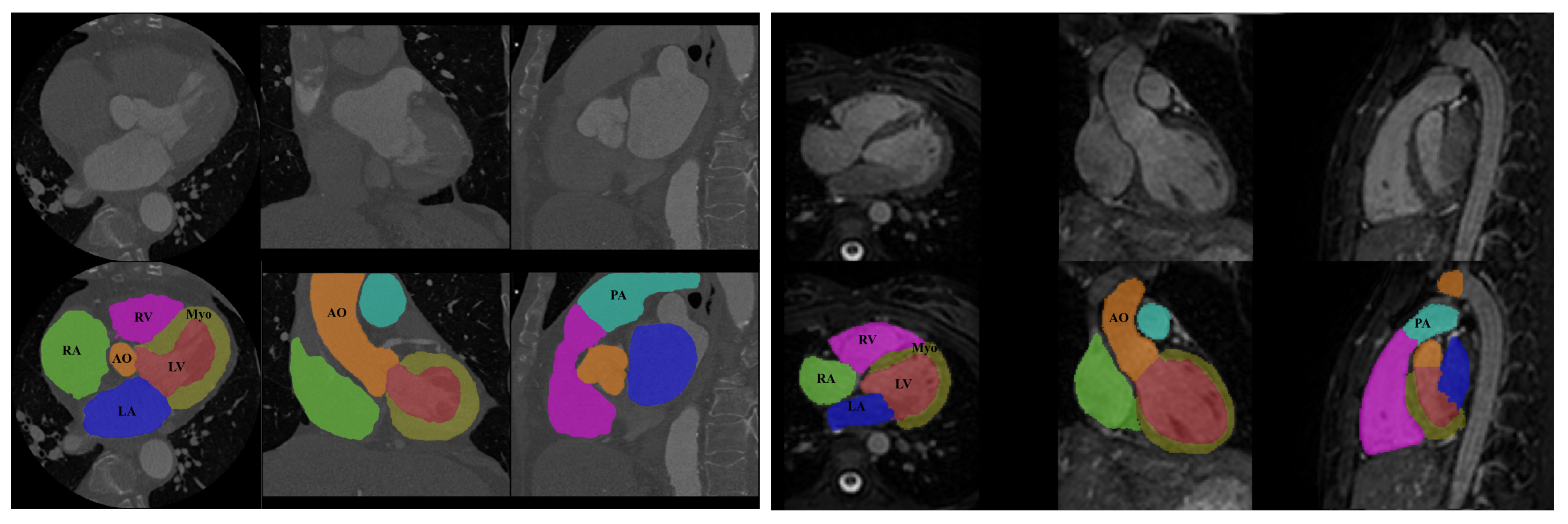 Applied Sciences | Free Full-Text | Whole Heart Segmentation Using 3D ...