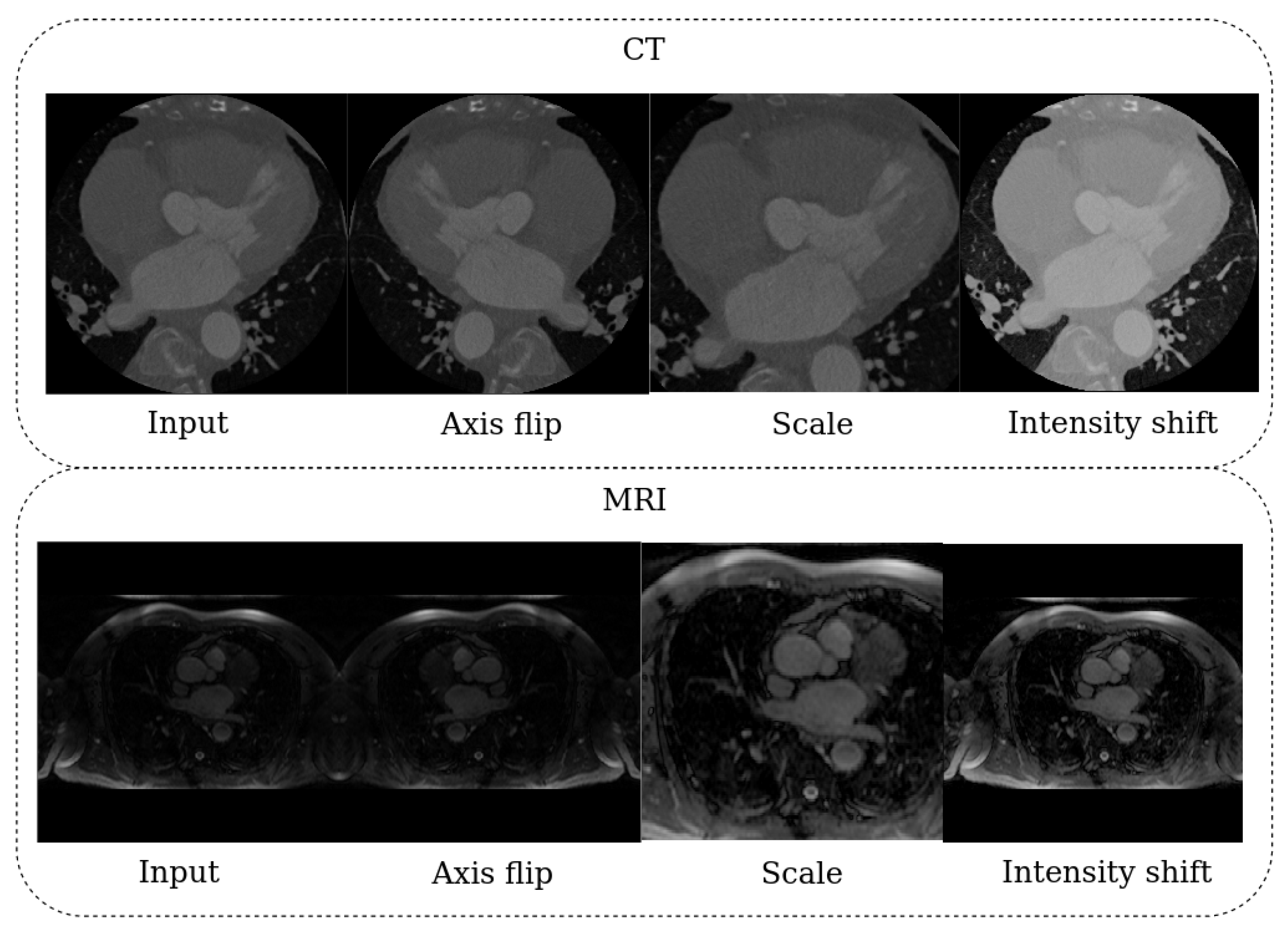 Applied Sciences | Free Full-Text | Whole Heart Segmentation Using 3D ...