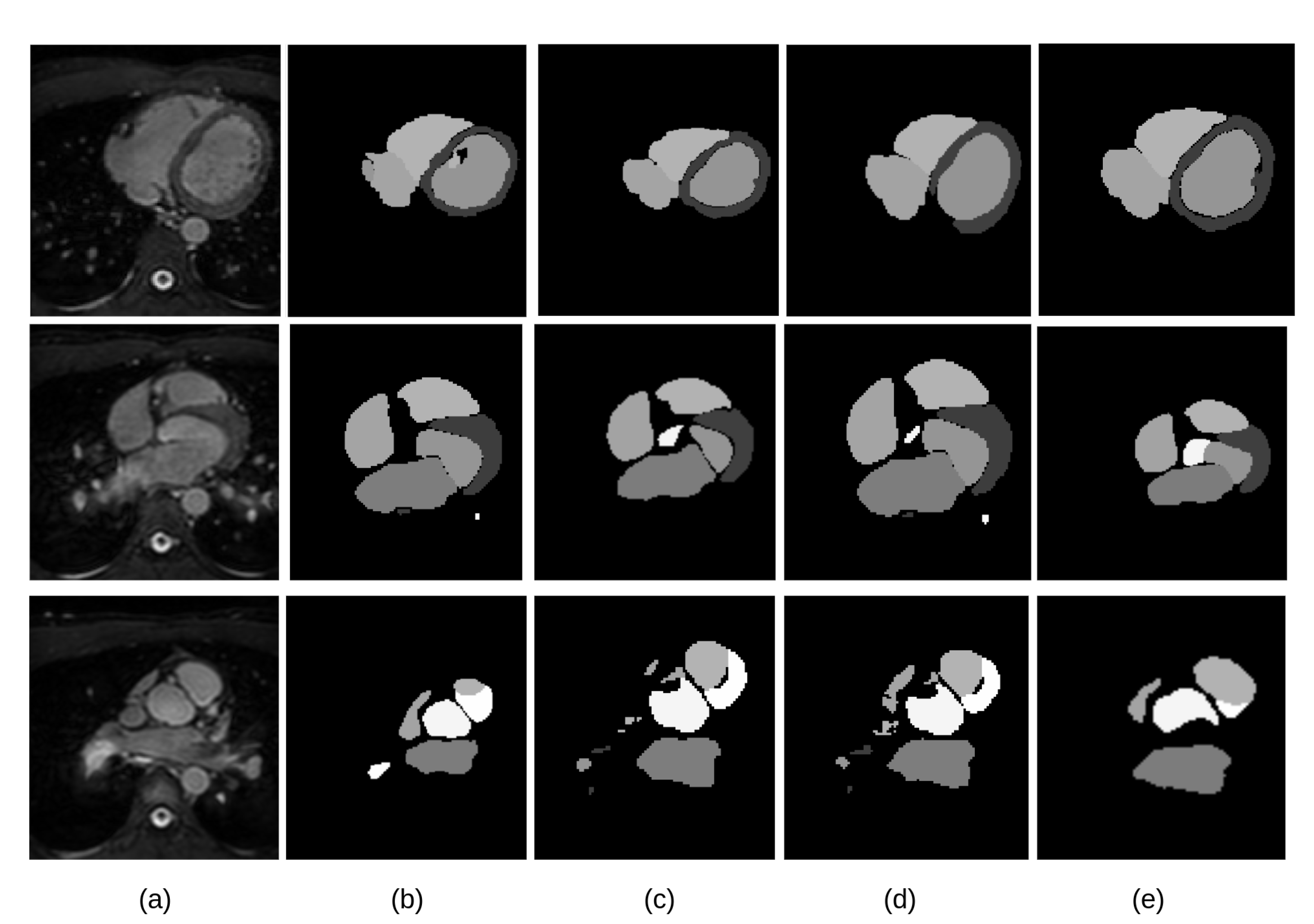 Applied Sciences | Free Full-Text | Whole Heart Segmentation Using 3D ...