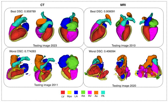 Applied Sciences | Free Full-Text | Whole Heart Segmentation Using 3D ...