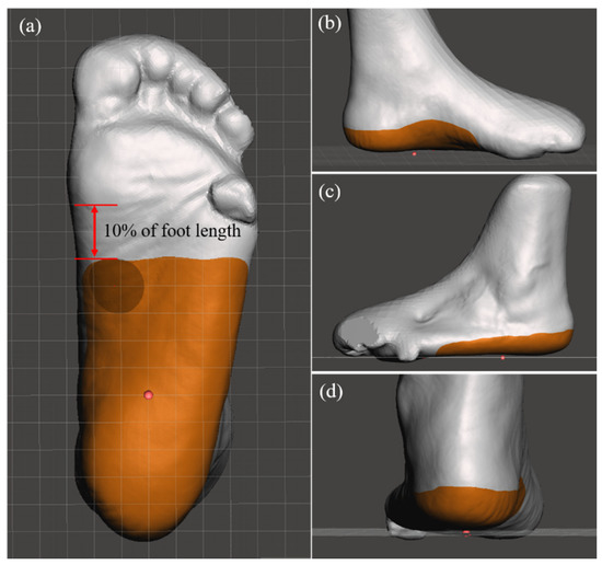 Biomechanical Effect of 3D-Printed Foot Orthoses in Patients with Knee ...