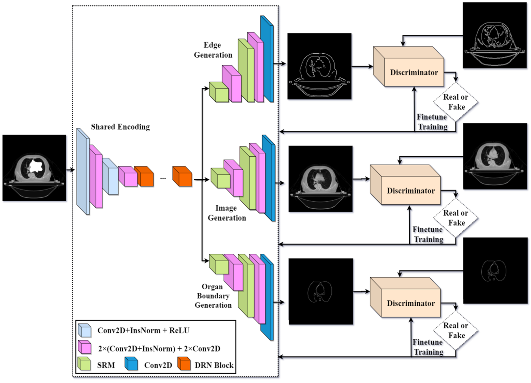 Multi-Task Learning for Medical Image Inpainting Based on Organ Boundary Awareness