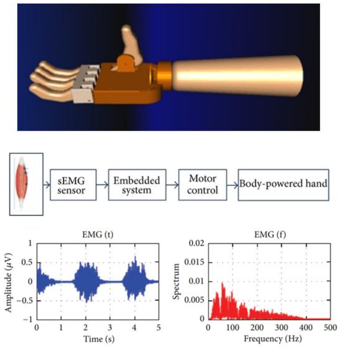 Recent Advances in Myoelectric Control for Finger Prostheses for ...