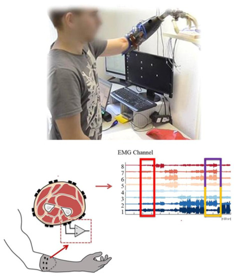 Recent Advances in Myoelectric Control for Finger Prostheses for ...