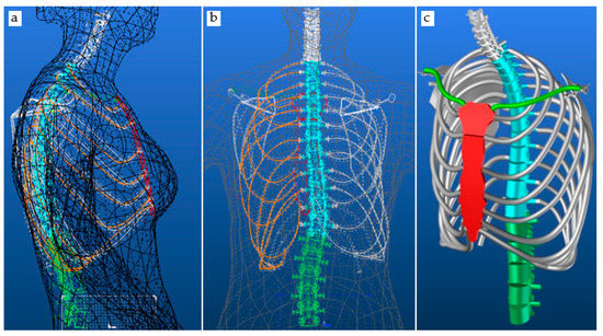 Applied Sciences | Free Full-Text | 3D Digital Adaptive Thorax ...
