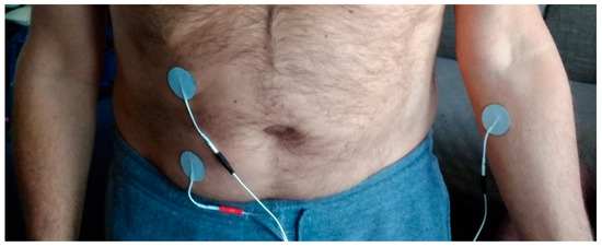 Processing of EMG Signals with High Impact of Power Line and Cardiac ...