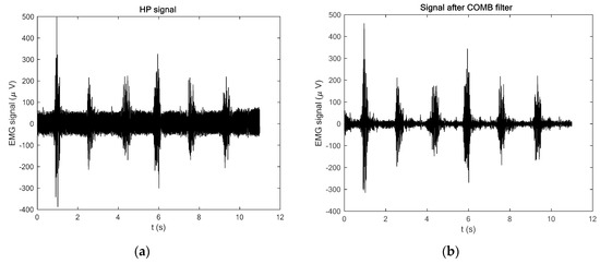 Processing of EMG Signals with High Impact of Power Line and Cardiac ...