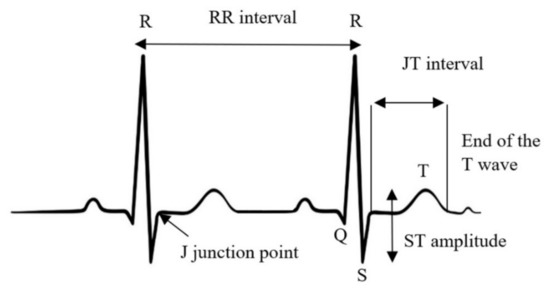 Detection of Ischemic Episodes Based on Two Consecutive Declines in the ...