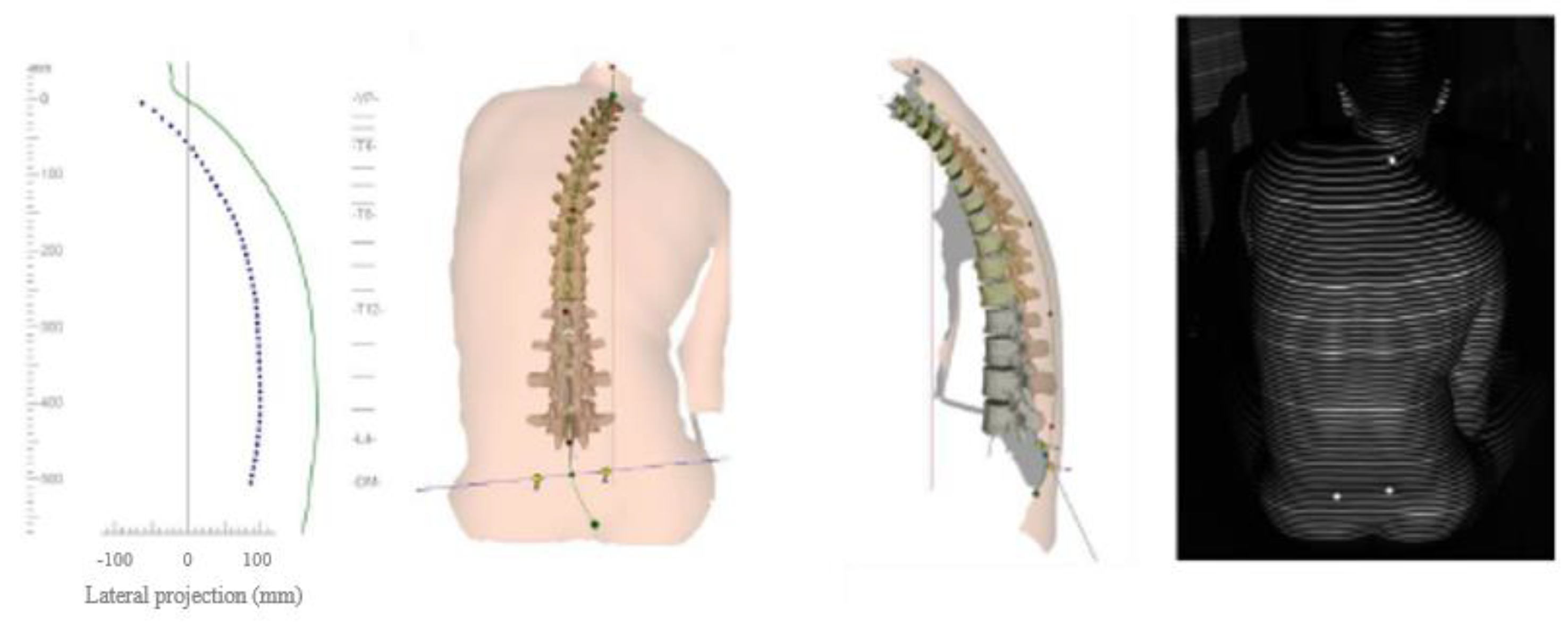 Influence of Various Types of Office Desk Chair for Dynamizing the ...