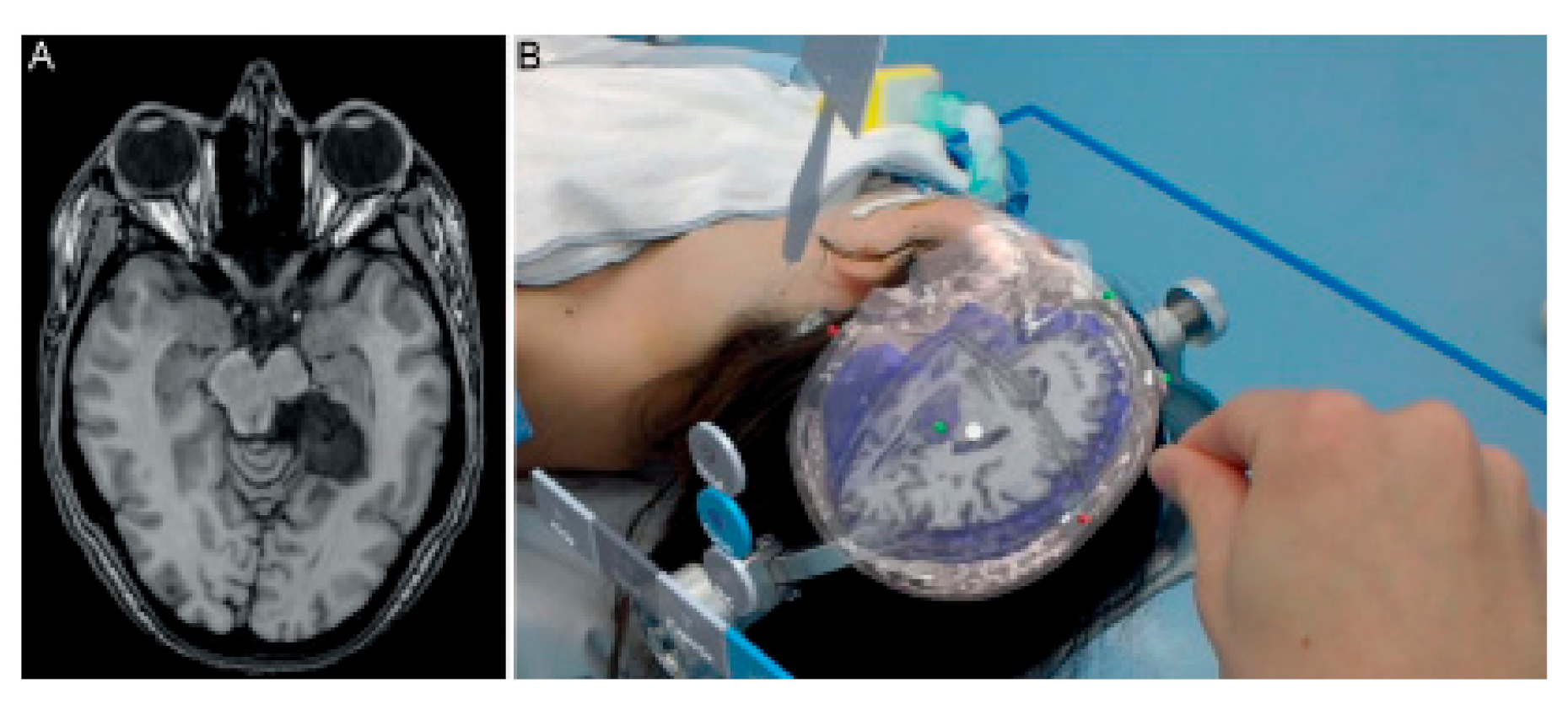 Applications of Smart Glasses in Applied Sciences: A Systematic Review