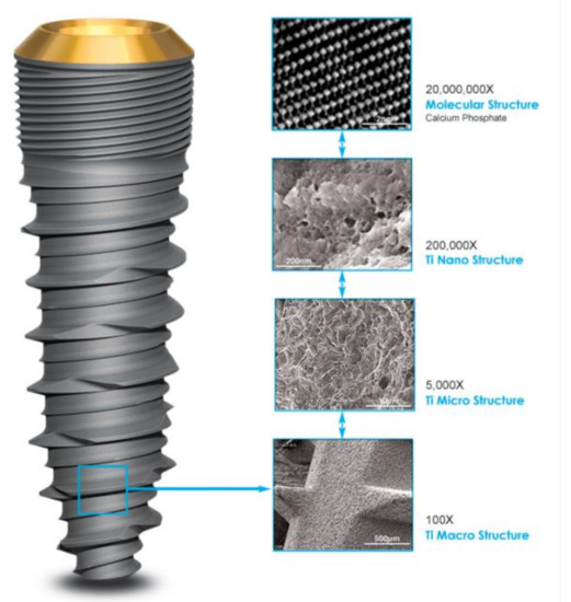 Rough Dental Implant Surfaces and Peri-Implantitis: Role of Phase ...