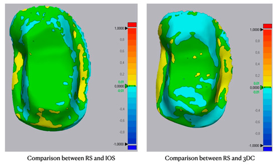 Applied Sciences | Free Full-Text | Digital Procedures Compared to ...