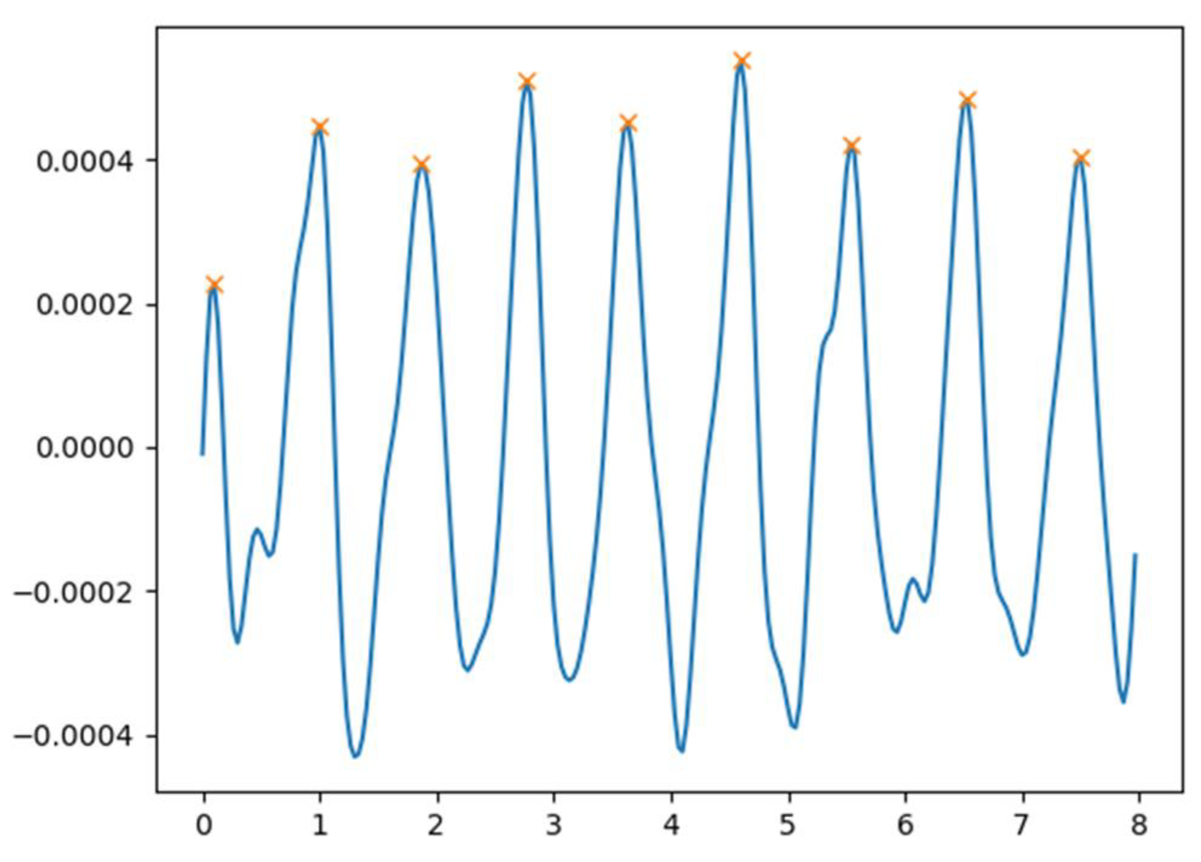 Research on Contactless Bio-Signal Measurement Technology for Improving ...