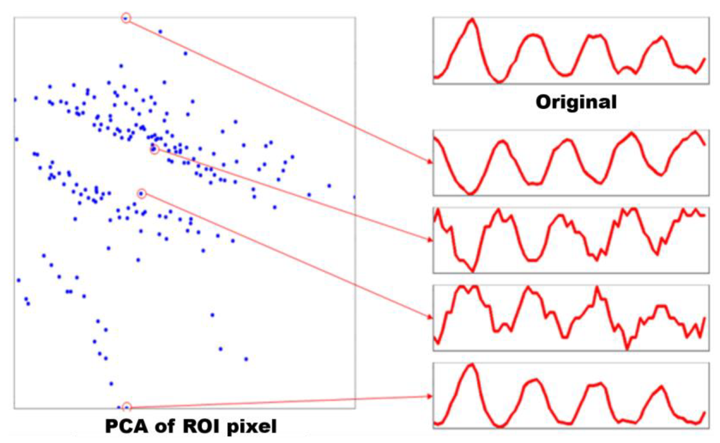 Research on Contactless Bio-Signal Measurement Technology for Improving ...