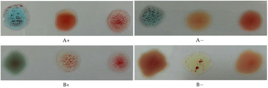An Efficient System for Automatic Blood Type Determination Based on ...