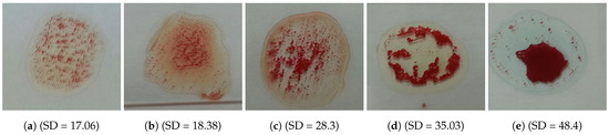 An Efficient System for Automatic Blood Type Determination Based on ...