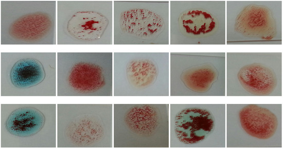 An Efficient System for Automatic Blood Type Determination Based on ...