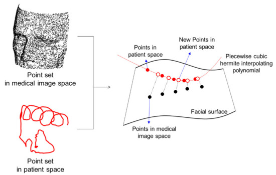 A Novel Patient-to-Image Surface Registration Technique for ENT- and ...