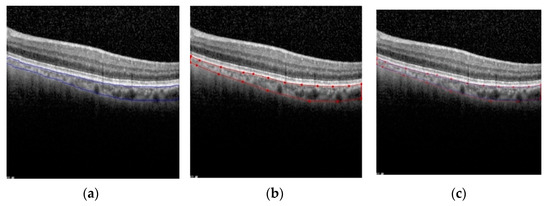 Applied Sciences | Free Full-Text | Automatic Segmentation of Choroid Layer Using Deep Learning ...