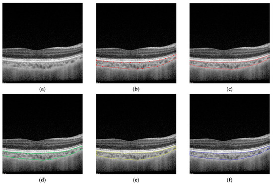 Applied Sciences | Free Full-Text | Automatic Segmentation of Choroid Layer Using Deep Learning ...