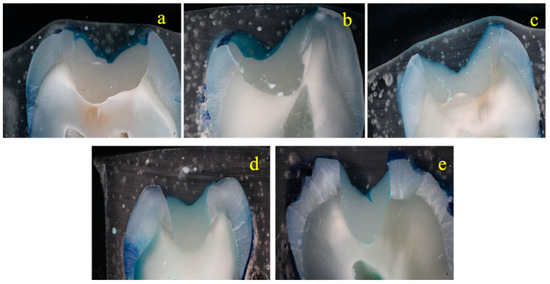 Marginal Adaptation Assessment for Two Composite Layering Techniques ...