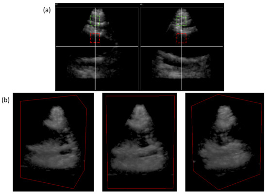 Real-Time Volumetric Ultrasound Research Platform with 1024 Parallel ...