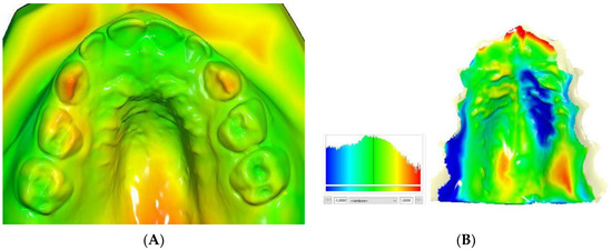 Digital (R)Evolution: Open-Source Softwares for Orthodontics