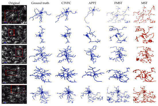 C3VFC: A Method for Tracing and Quantification of Microglia in 3D ...