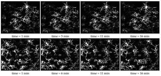 C3VFC: A Method for Tracing and Quantification of Microglia in 3D ...