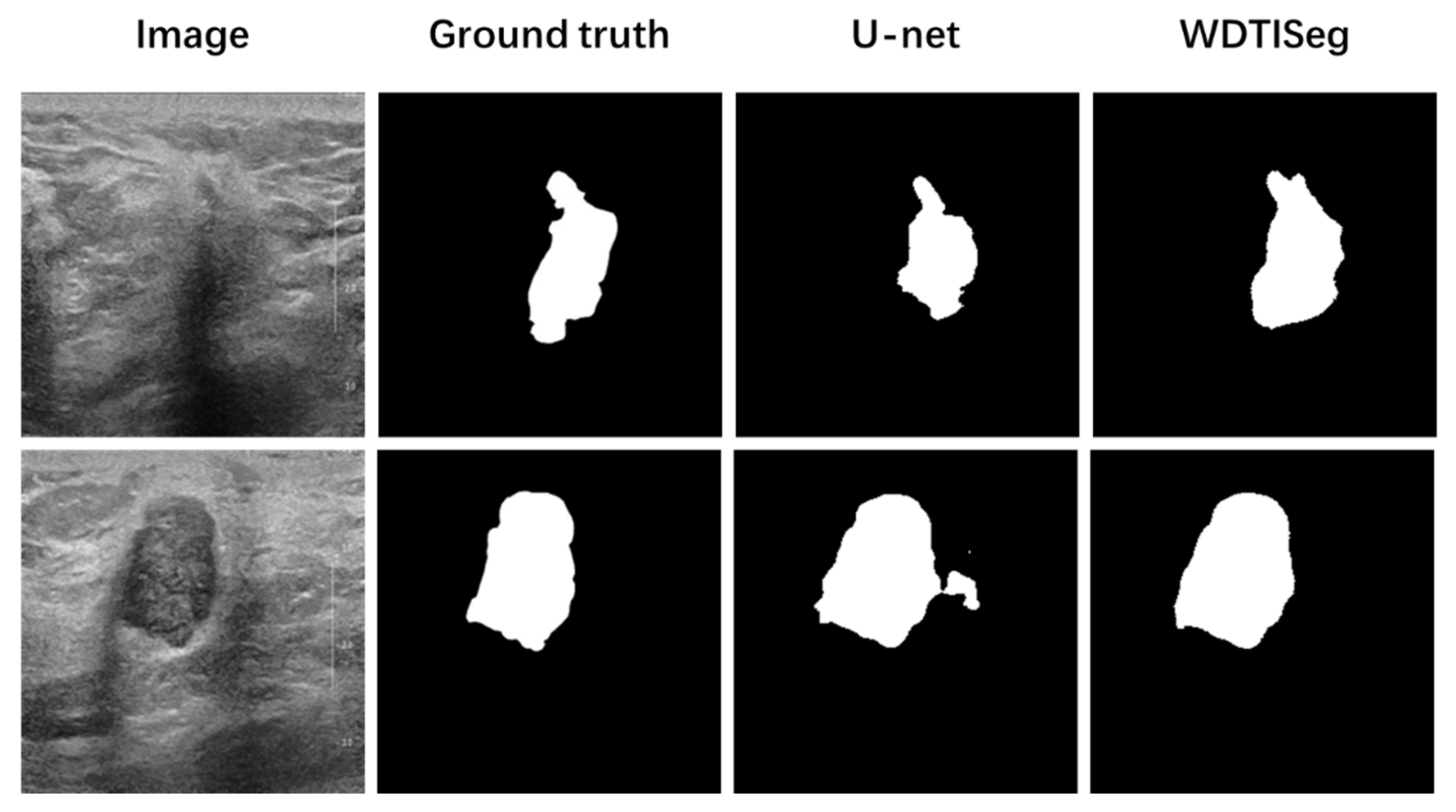 Applied Sciences Free Full Text Wdtiseg One Stage Interactive