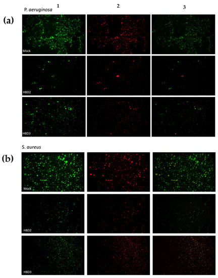 The Intestinal Biofilm of Pseudomonas aeruginosa and Staphylococcus ...