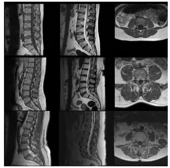 Image Quality Assessment to Emulate Experts’ Perception in Lumbar MRI ...