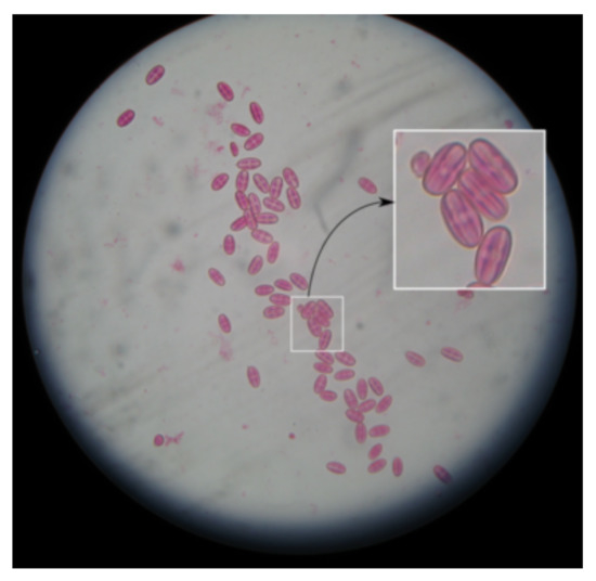 Segmenting 20 Types of Pollen Grains for the Cretan Pollen Dataset v1 ...