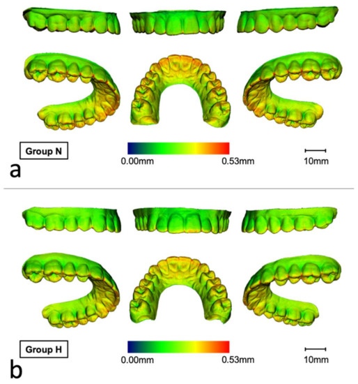 Applied Sciences | Free Full-Text | Impact of Dental Model Height on ...
