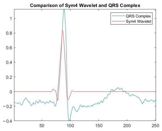 System for Neural Network Determination of Atrial Fibrillation on ECG ...