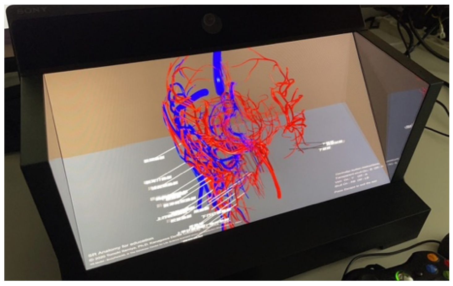 A Novel Anatomy Education Method Using a Spatial Reality Display ...