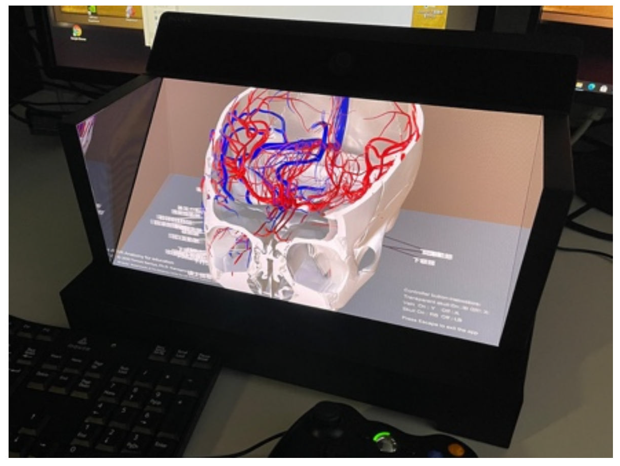 A Novel Anatomy Education Method Using a Spatial Reality Display ...