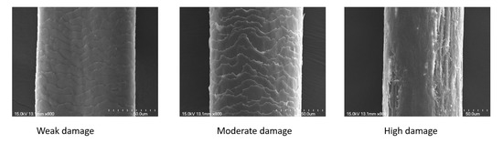 Efficient Hair Damage Detection Using SEM Images Based on Convolutional ...