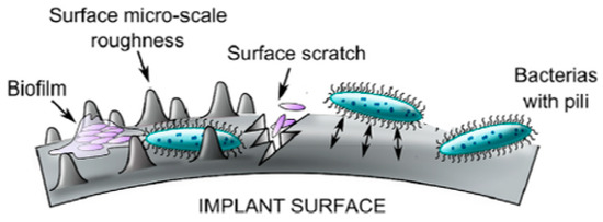 Advances in Biomaterials for Breast Reconstruction