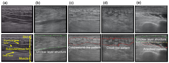 Development of an Automatic Ultrasound Image Classification System for ...